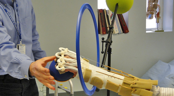Southampton Hospital occupational therapist custom makes hand therapy ...